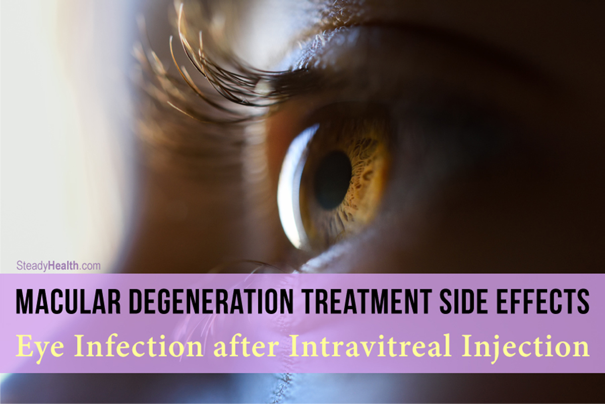 Macular Degeneration Treatment Side Effects Eye Infection After 