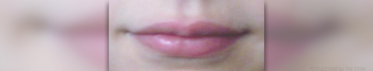 Dry Skin Around Mouth Skin Hair Problems Articles Body Health Conditions Center 