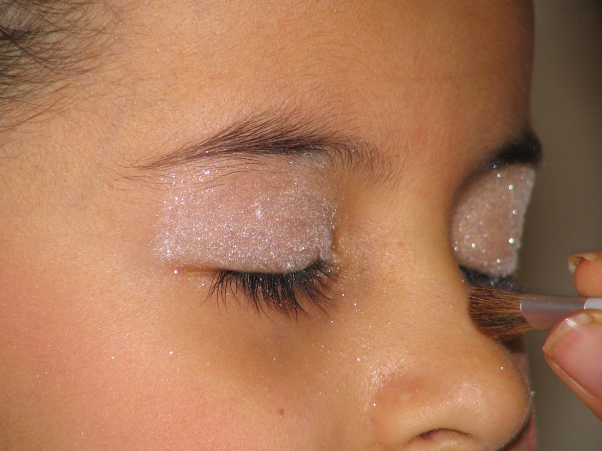 Dry Scaly Eyelids General Center SteadyHealth