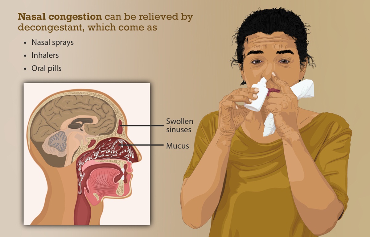 Excessive Mucous Production Causes Diagnosis And Treatment Ear 