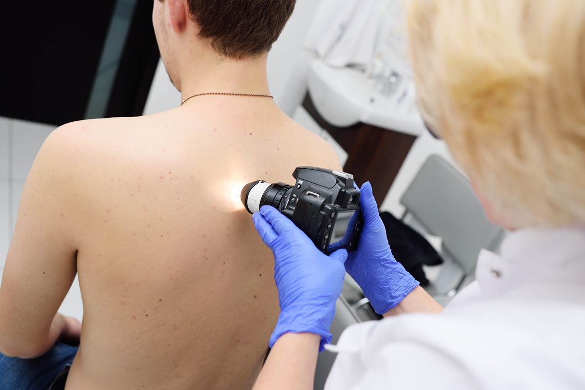 Skin Hemangioma Causes Clinical Presentation And Treatment Skin And Hair Problems Medical