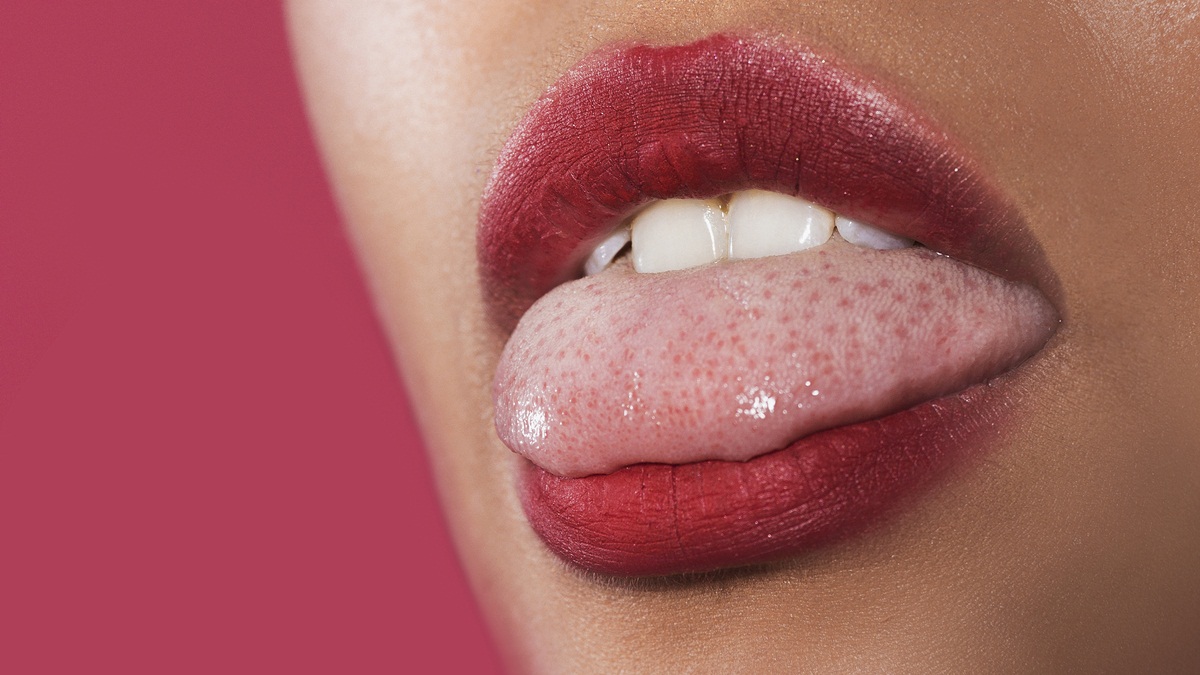 A Bump On The Side Of The Tongue Ear Nose Throat And Dental 