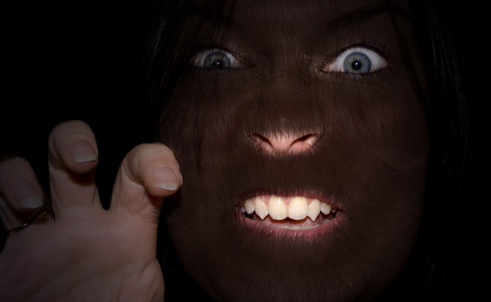 Hypertrichosis: The Hair You Wish You Never Had | Skin & Hair problems ...